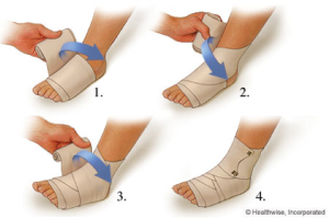 Simple Techniques for Bandaging Wounds – SurvivalKit.com